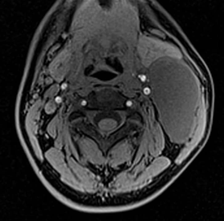 Resonancia Magnética de Cuello - Centro de Diagnóstico por Imágenes ...